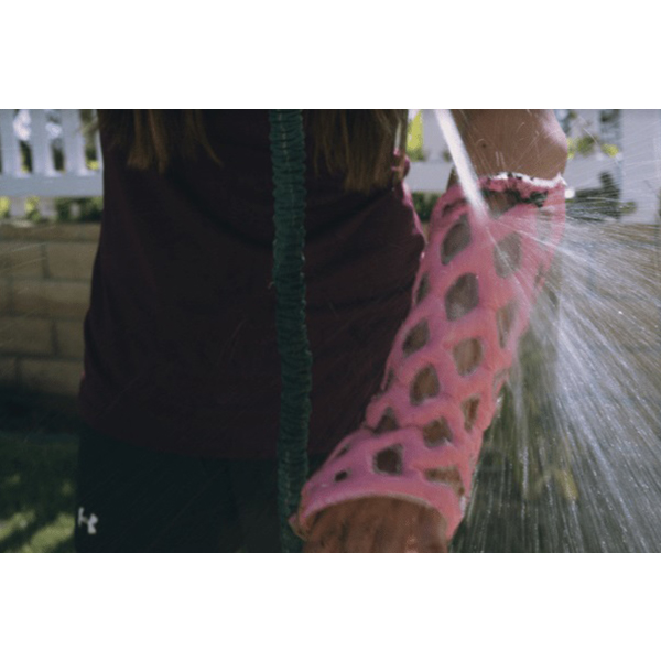 Cast 21 – Innovative casting and bracing - Medpick